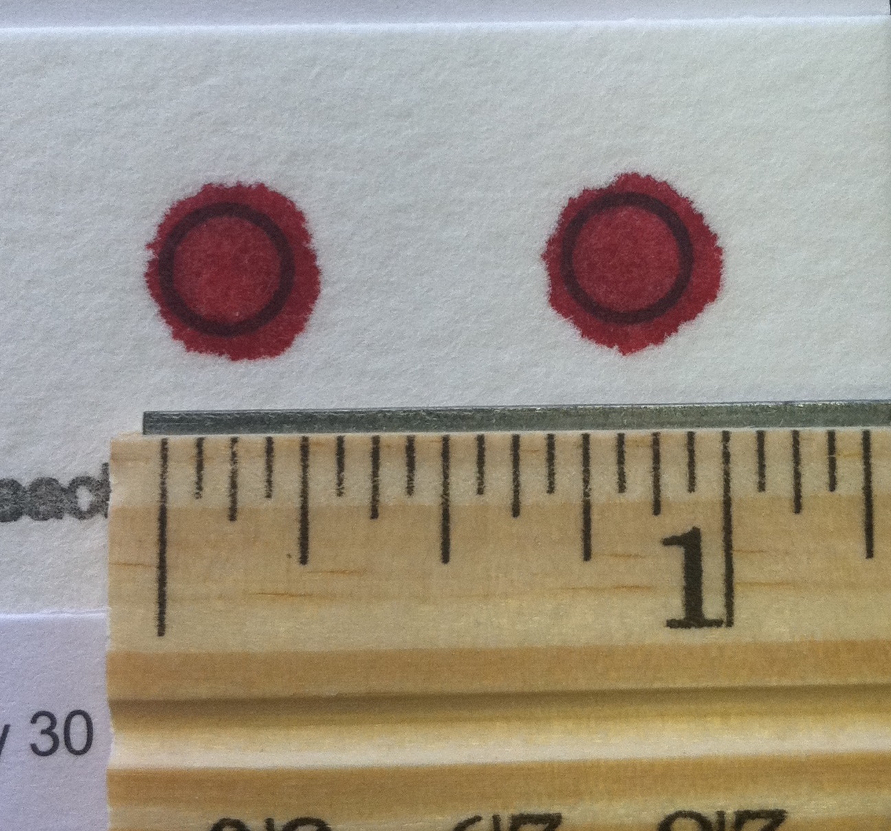 measured blood spot - GrassrootsHealth